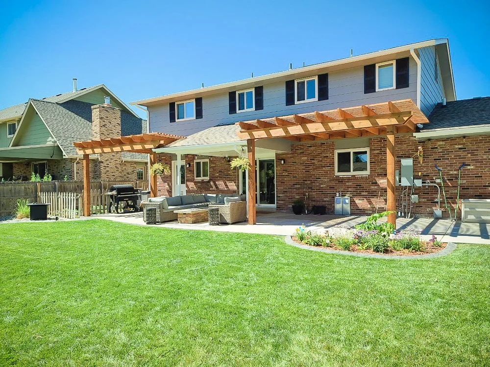 Denver Pergolas, Custom Builders | Premium Decks & Pergolas