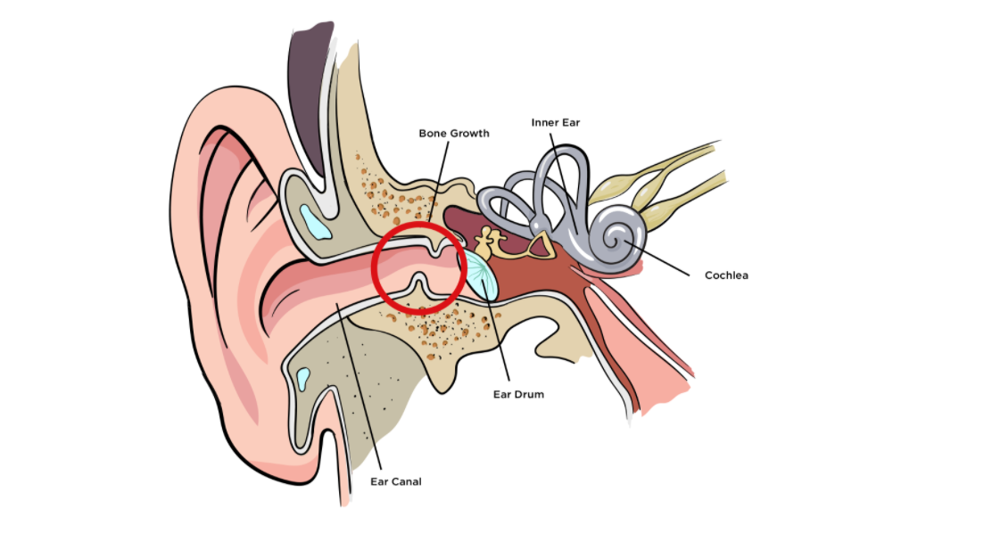 Swimmers Ear — WILD SWIMMING CORNWALL