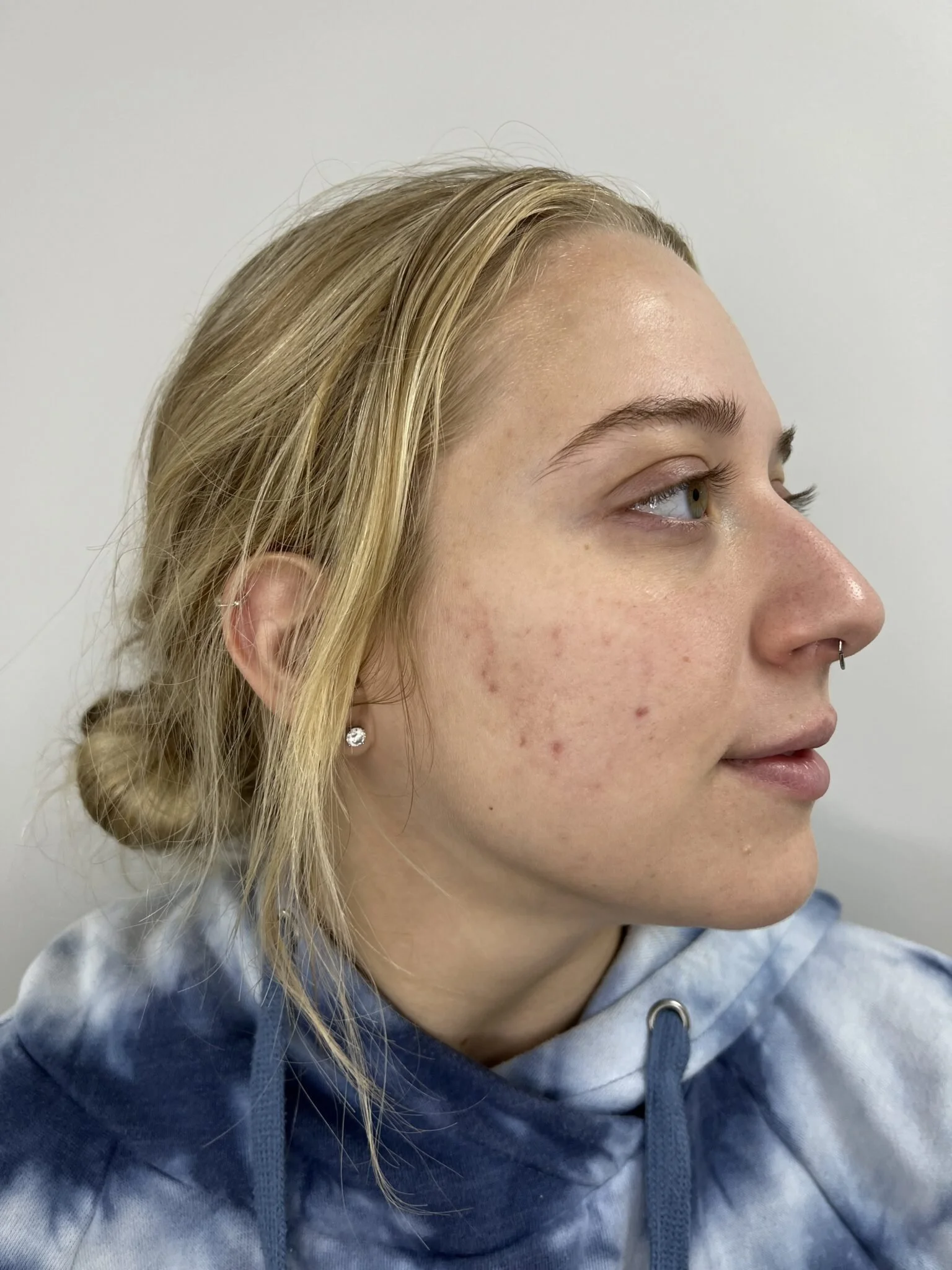 Microcurrent Therapy: A Natural Wellness Treatment for Healing and ...