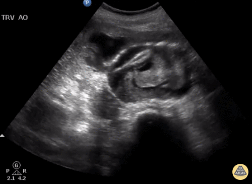 Services 4 — Denver Ultrasound
