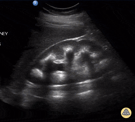 Services 4 — Denver Ultrasound