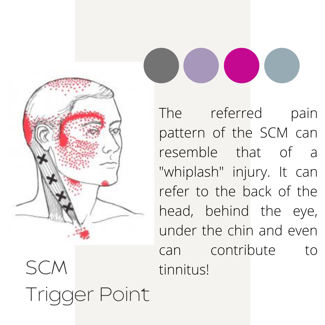 About Dry Needling and Trigger Point Acupuncture – Sundala Wellness