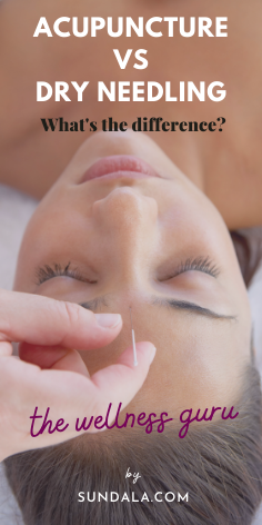 Acupuncture vs Dry Needling — Wellness Blog — Sundala Wellness