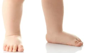 Pediatric Flatfoot: Understanding Flat Feet in Children — Feet Made Simple