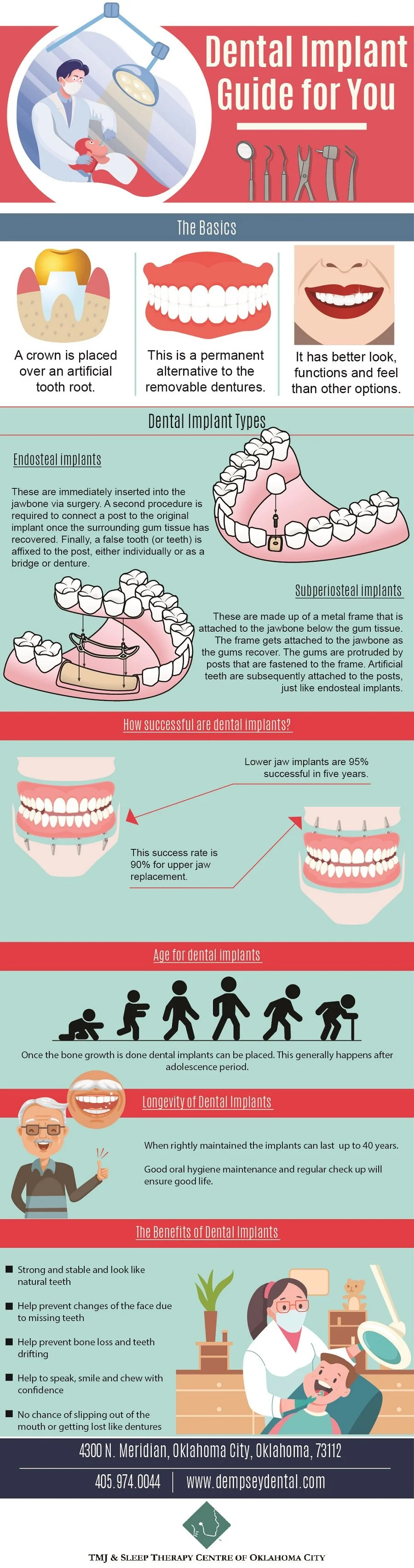 Dental Implant Guide for You (Infographic)