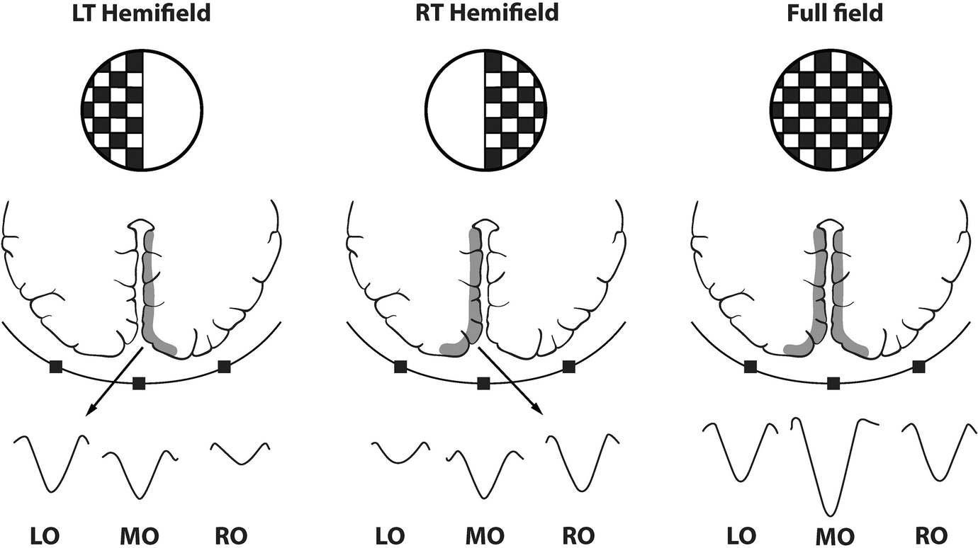We're only seeing half the picture — Neurophysiological Sciences ...