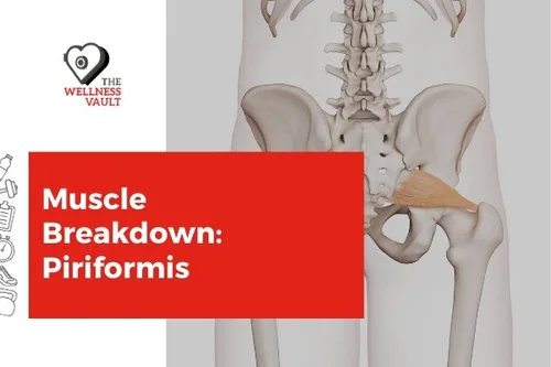 Multifidus Triangle Syndrome