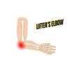 Understanding Lifter's Elbow: Causes and Symptoms