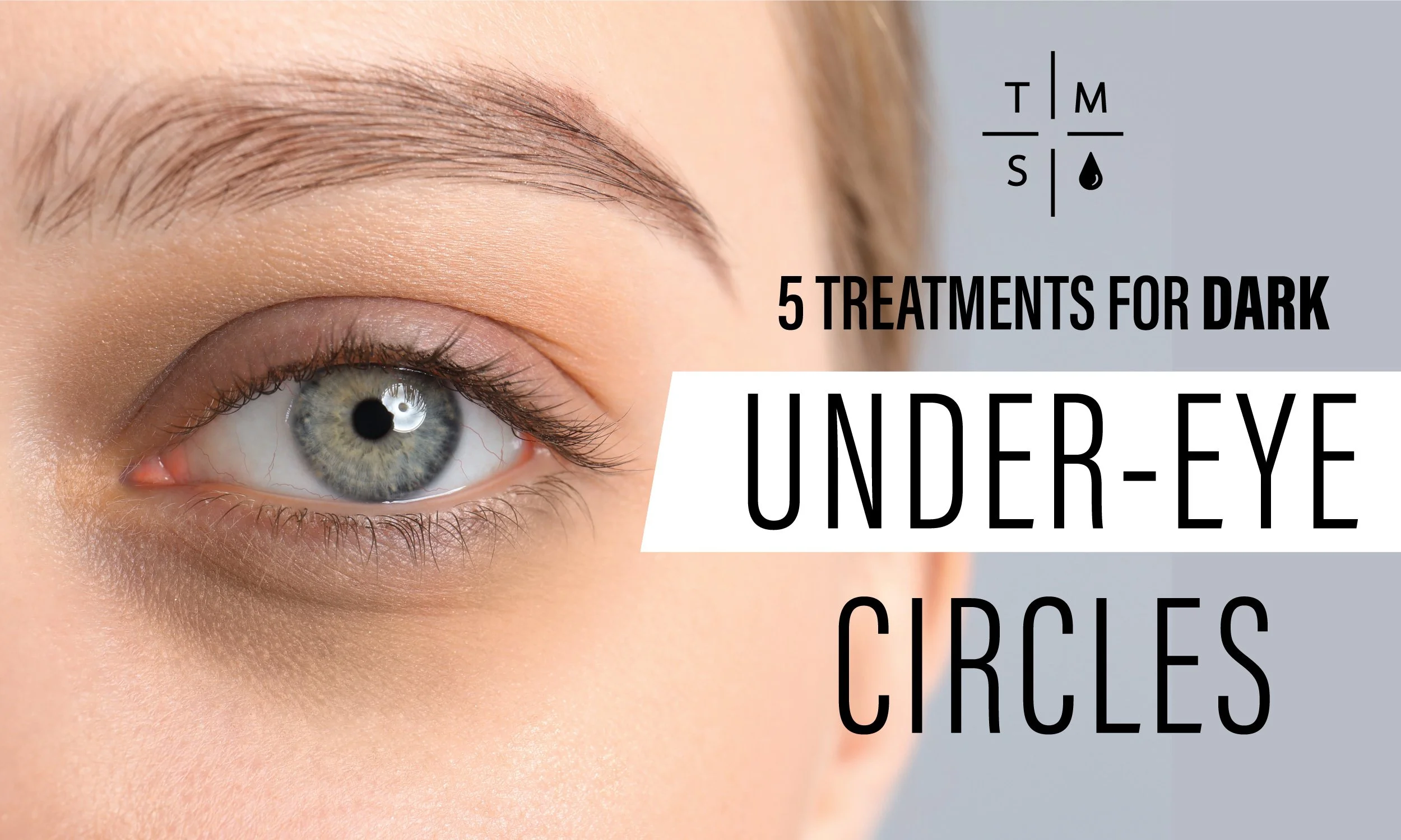 5 Treatments to Get Rid of Dark Under-Eye Circles — The Med Spa