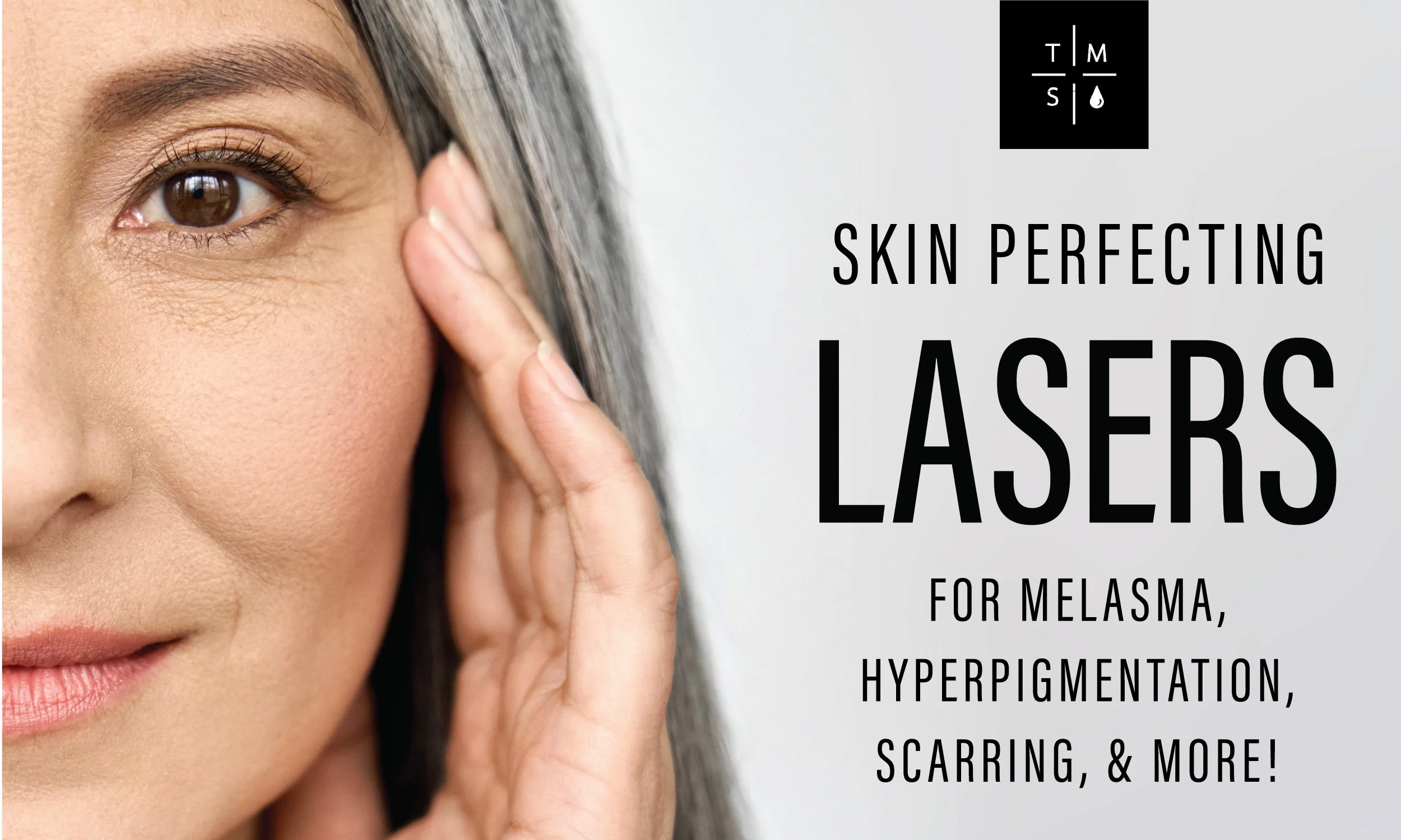 Lasers for Hyperpigmentation & Melasma — The Med Spa