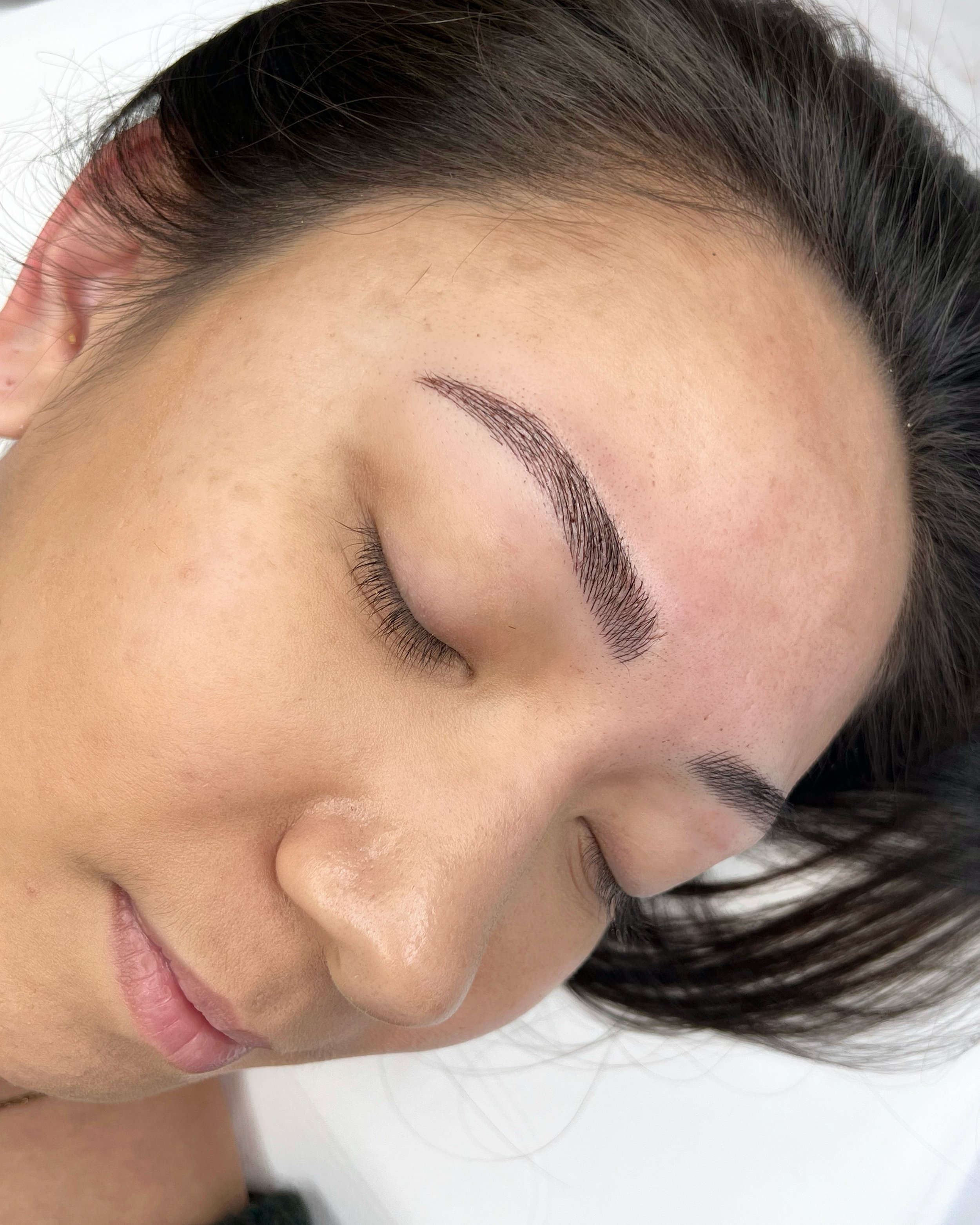 Services — Areté Aesthetics