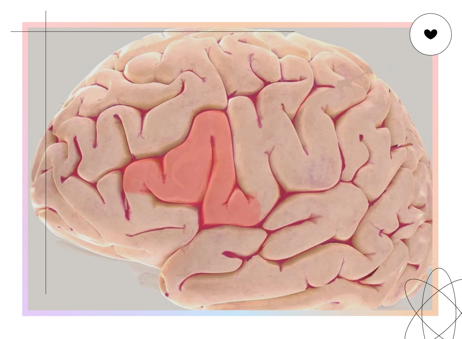 LOCALISATION OF FUNCTION IN THE BRAIN — NEUROSCIENCE | Discover ...