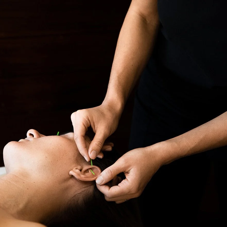 Acupuncture and Yoga Nidra — Humble Haven Yoga : Richmond Power Yoga