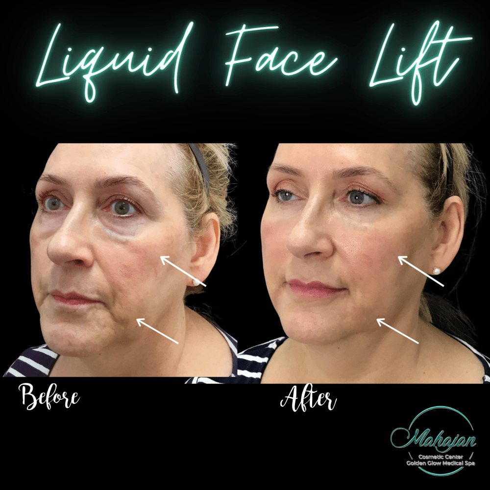 Medical Spa Images | Belleair Fl | Mahajan Cosmetic Center — Golden ...