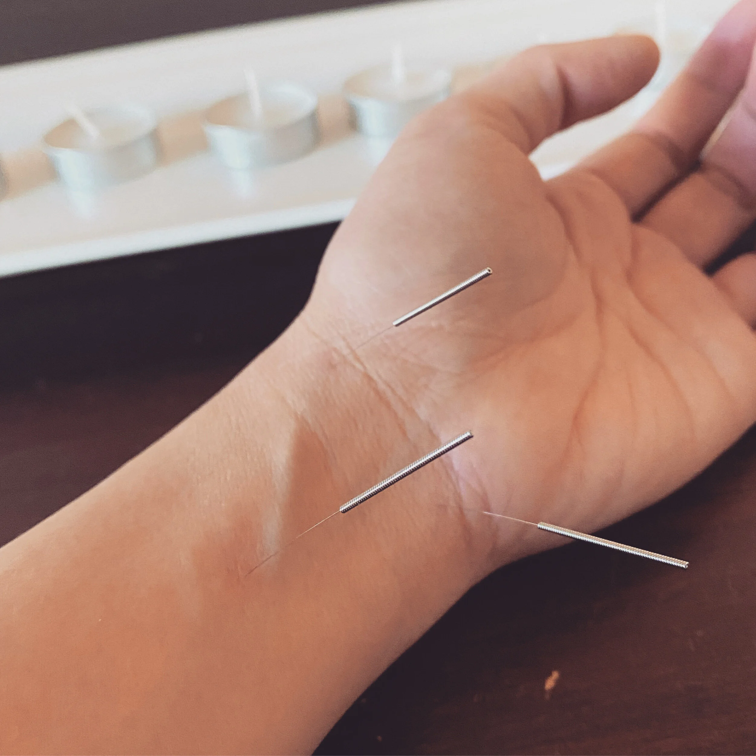 NOW Acupuncture - Chi Huang, L.Ac.