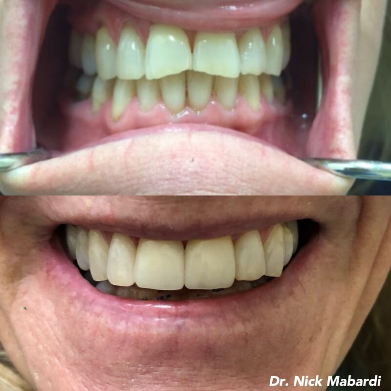 South Miami Smile Gallery | Mabardi Dental Studio