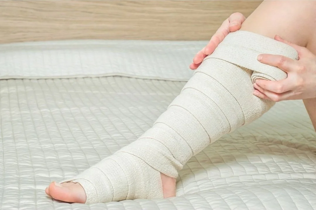 Lymphedema — Chicago Physical Therapists