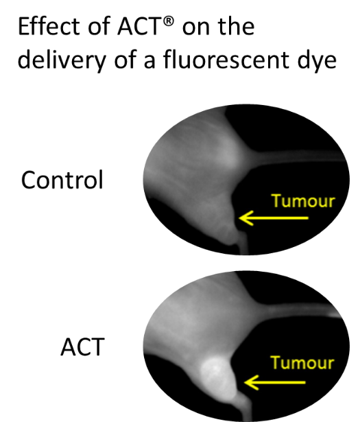 General 1 — EXACT THERAPEUTICS