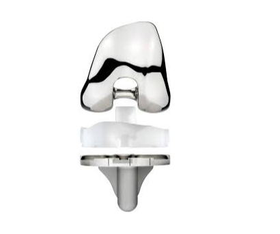 Pros and cons of different types of knee implants - Dr. Kurtz ...