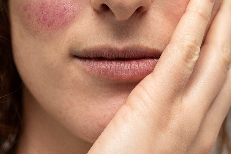 Medical & Cosmetic Dermatologist Treatments | DERM Lab