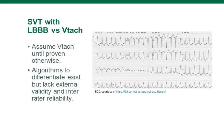 SVT on the ECG! — USF Emergency Medicine