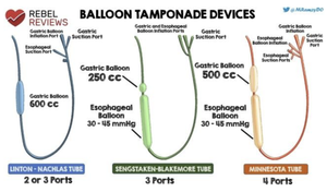 Balloon Tamponade in GI Bleed — USF Emergency Medicine