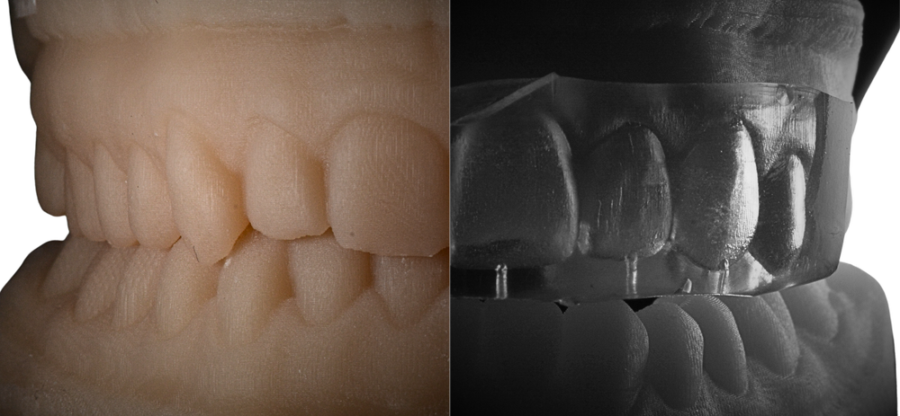 Digital Prosthetics Ltd