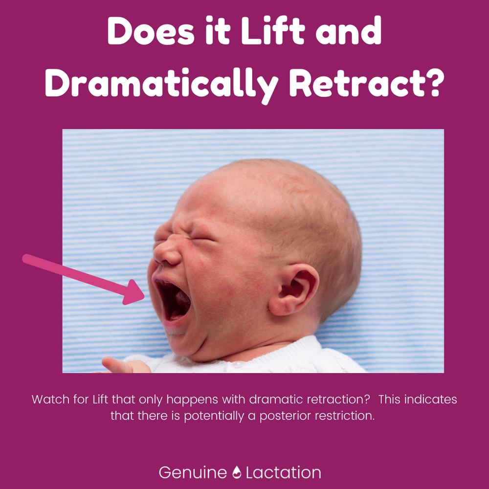 What Should your Baby’s Tongue and Jaw Do? — Genuine Lactation