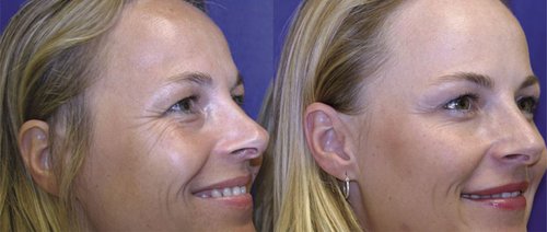 Dr Emmaline Ashley, Cosmetic Physician