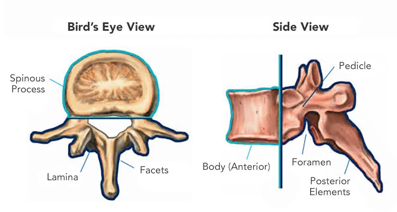 Open Laminectomy – Lumbar Spine Surgeries – The American Center for ...