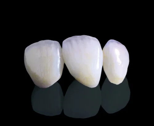 emax — MODERN DENTAL