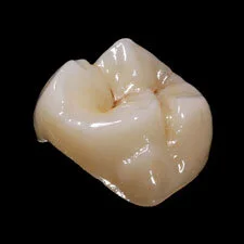 IPS e.max — MODERN DENTAL