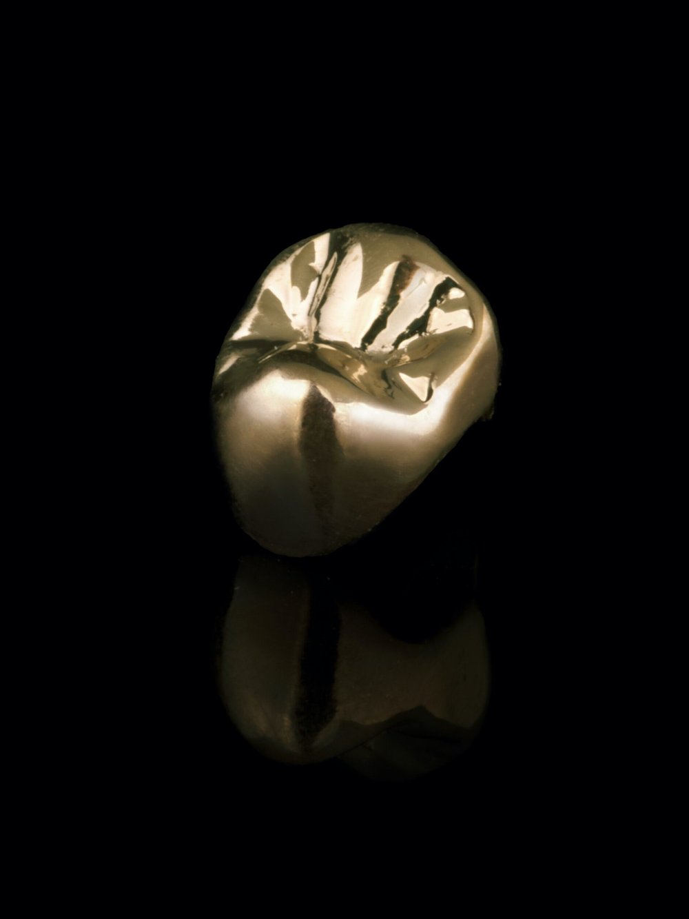 Gold Crowns and Bridges — MODERN DENTAL