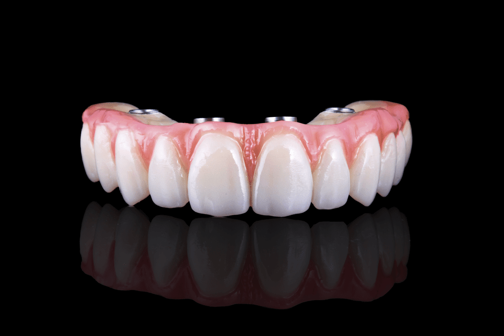 All-On-X — MODERN DENTAL