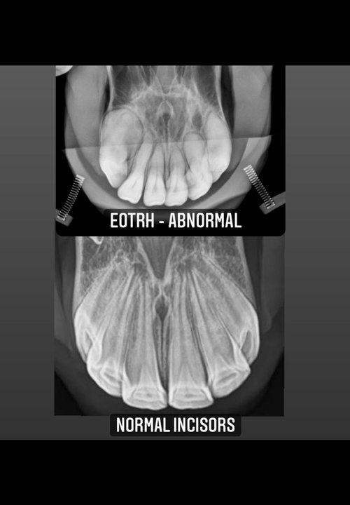 Equine Odontoclastic Tooth Resorption and Hypercementosis (EOTRH)