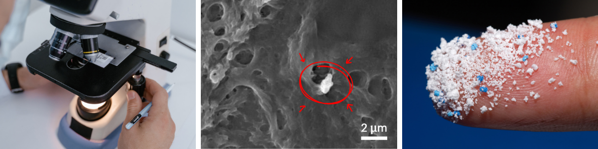 Plastics Have Infiltrated the Human Brain — Beyond Plastics - Working ...