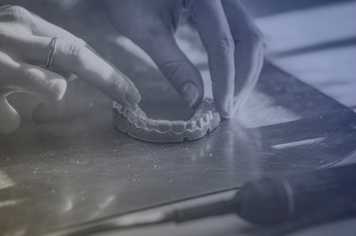 Essix Retainers — Pinnacle Prosthetics