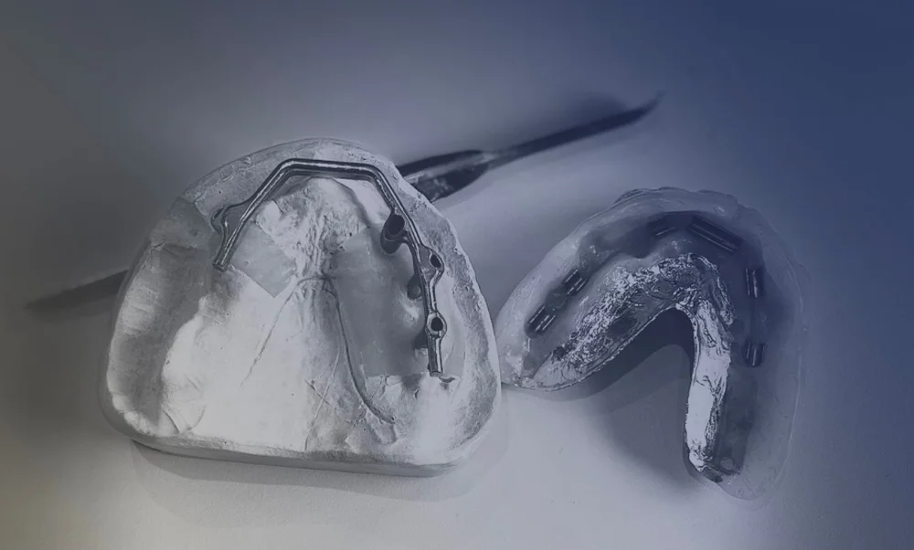 Implants — Pinnacle Prosthetics