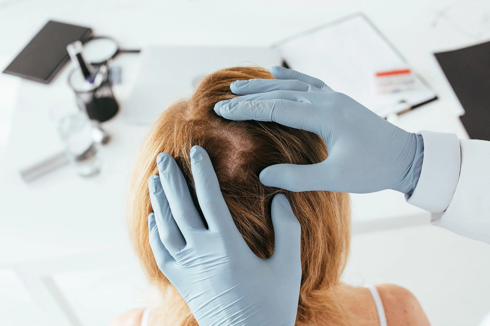 Hair Loss and scalp disorders Brisbane — Skin Partners | Brisbane ...
