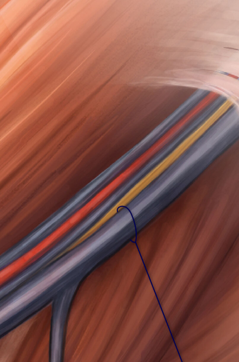 Henry Approach to the Radius - medical illustration — Biotic Artlab