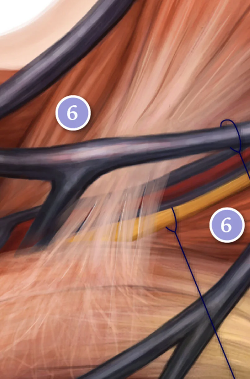 Henry Approach to the Radius - medical illustration — Biotic Artlab