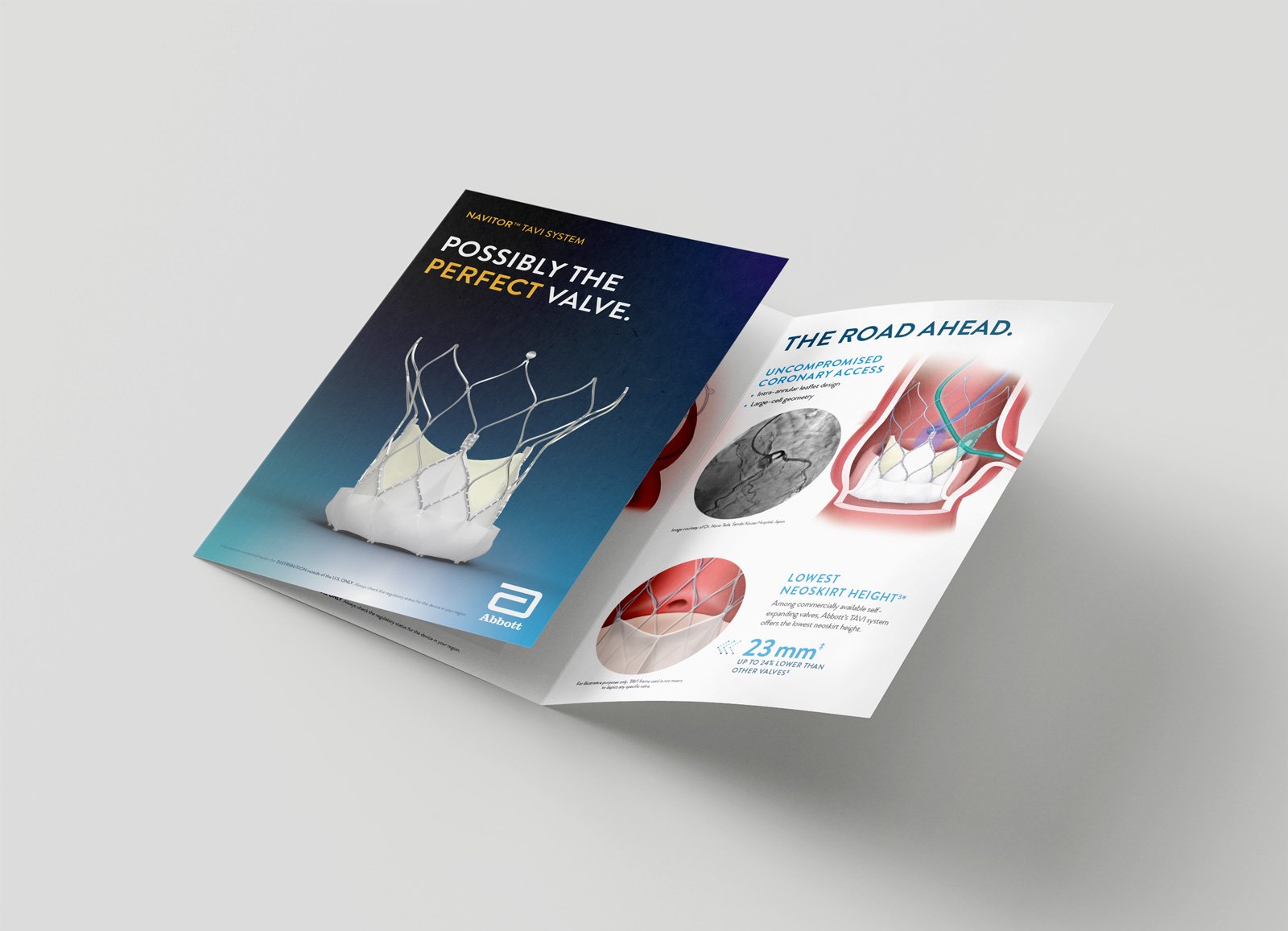 Navitor TAVI System Heart Valve • Medical Illustrations — Biotic Artlab
