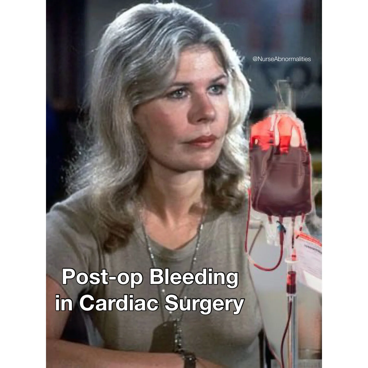 Nurse Abnormalities