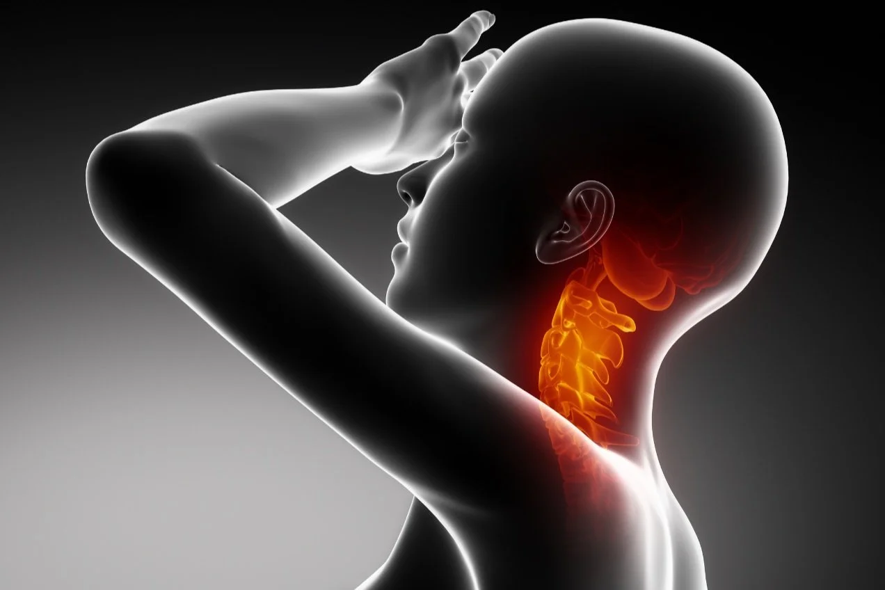 Cervicogenic Headache | Shellharbour Physiotherapy
