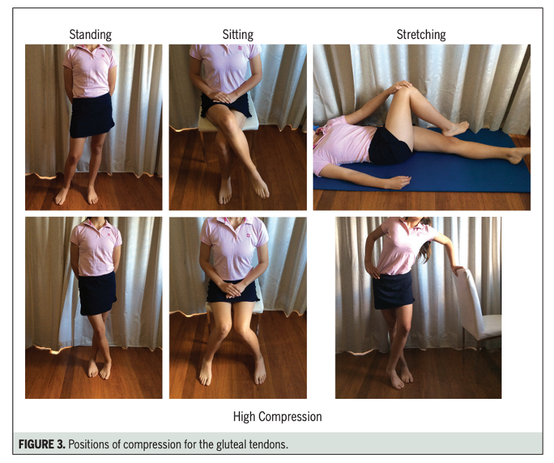 “Ban the Clam” — Rethinking the clamshell exercise in post hip ...