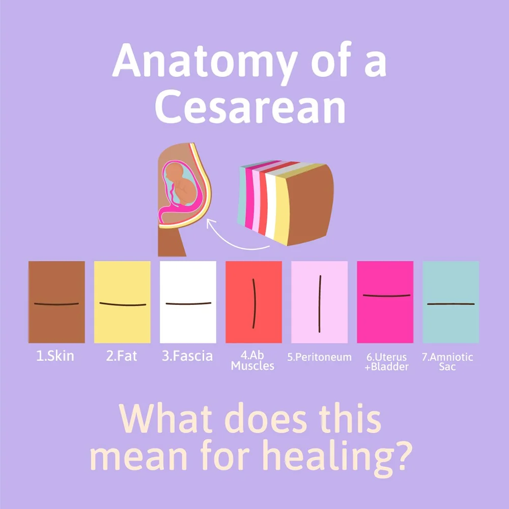 C-Section Recovery- The First 2 Weeks — LONGEVITY & PERFORMANCE INSTITUTE