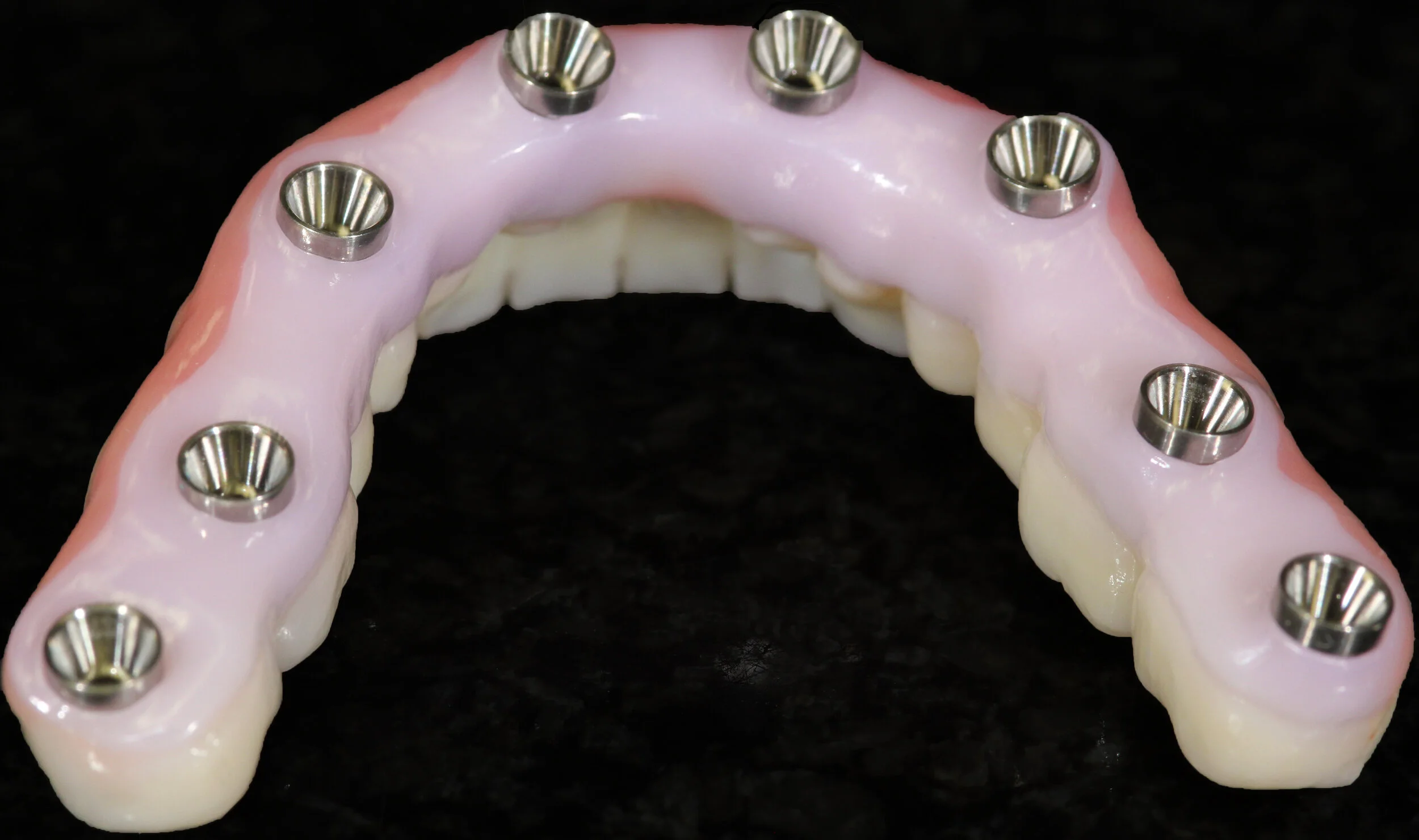 Restorations — SYNrG Lab