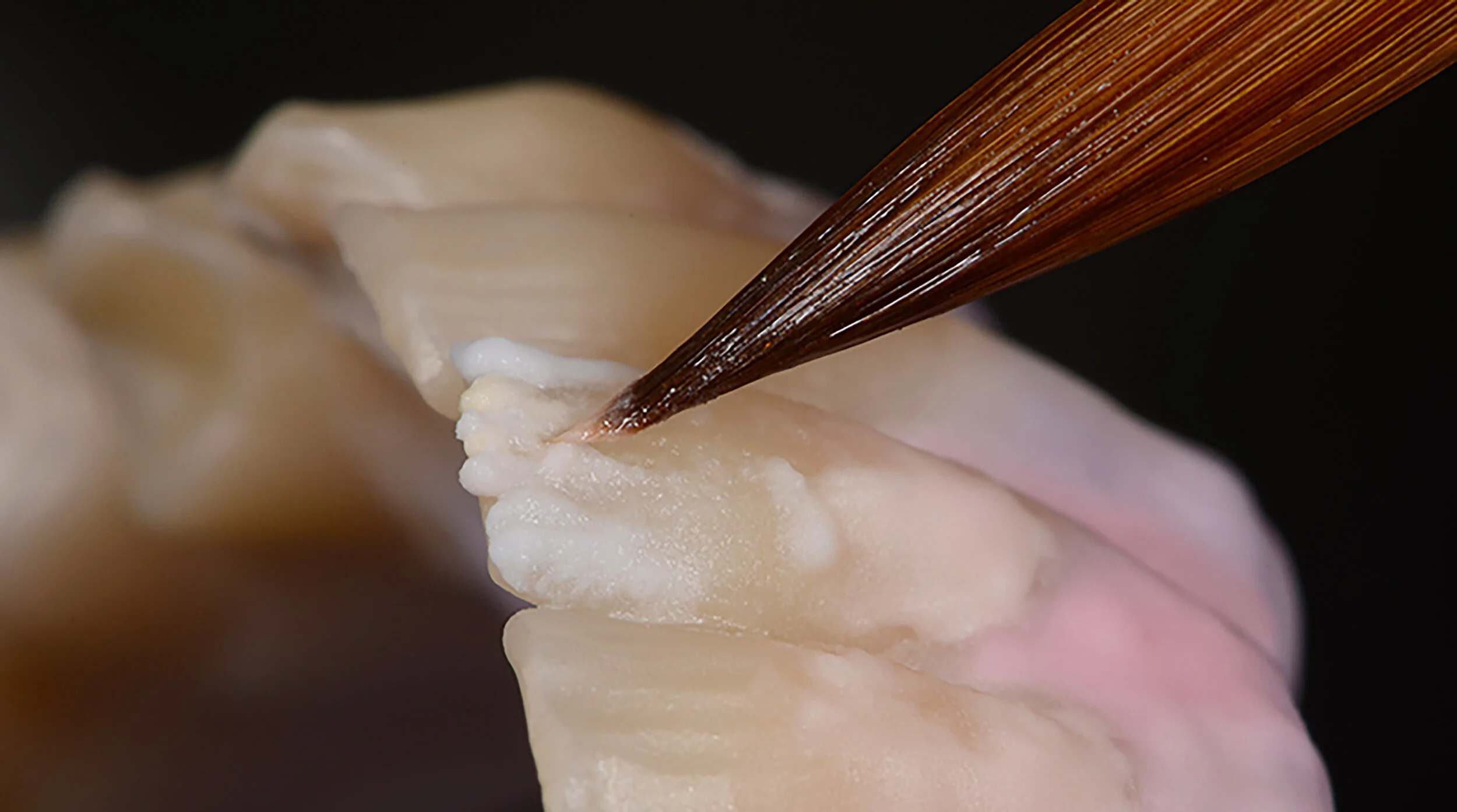 Restorations — SYNrG Lab