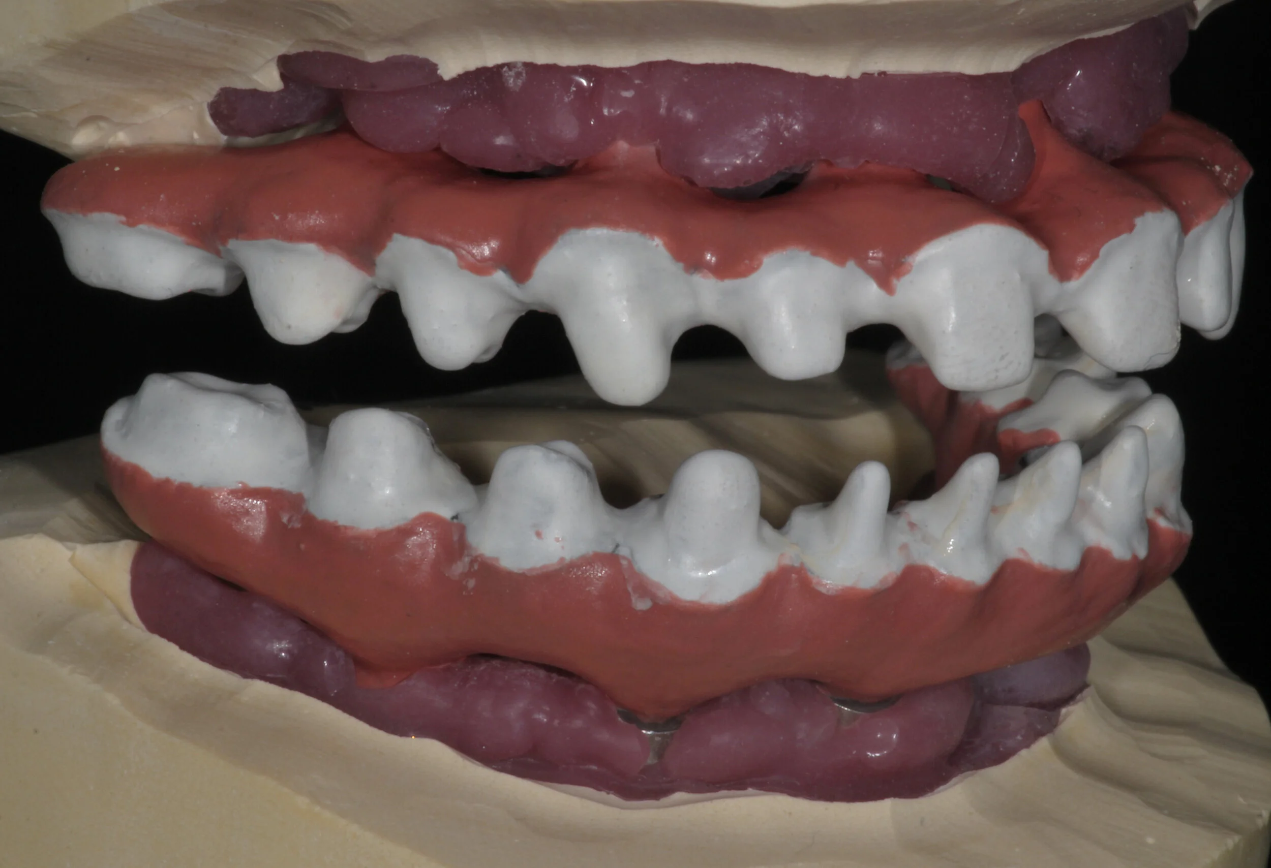 Restorations — SYNrG Lab