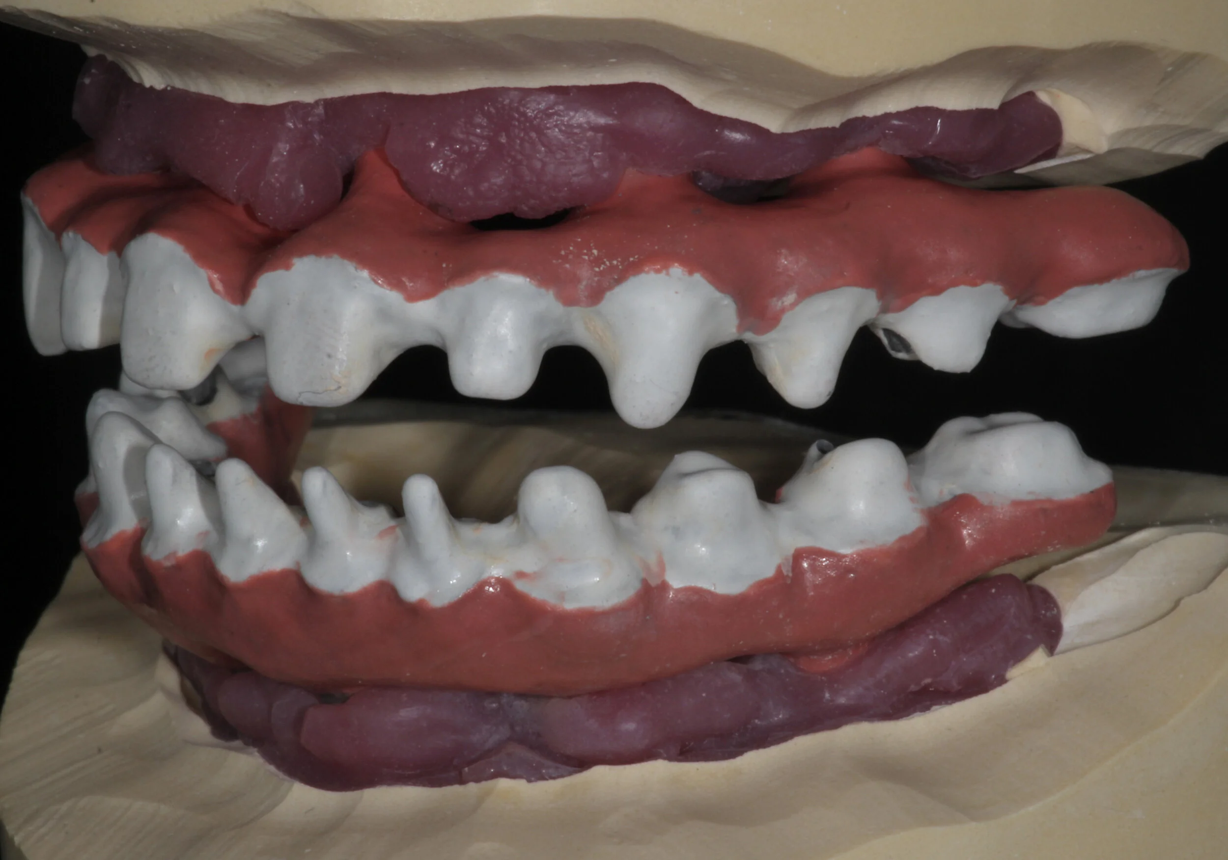 Restorations — SYNrG Lab